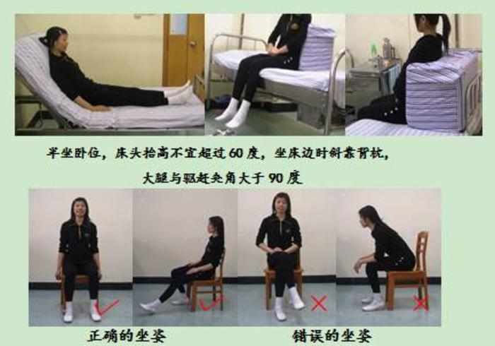人工髋关节置换术后康复指导手册 微医（挂号网）