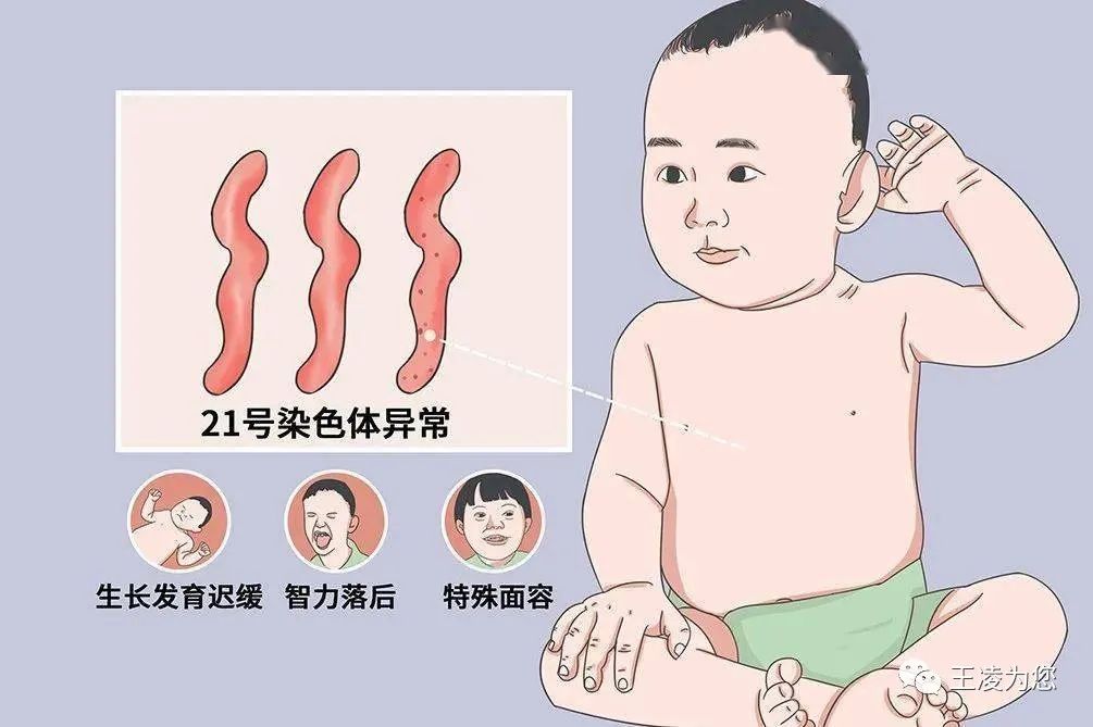 不孕症、习惯性流产为什么要查高分辨染色体核型分析 微医（挂号网）