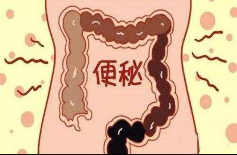 便秘 微医（挂号网）
