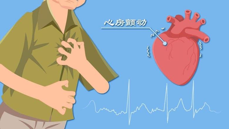 房颤终结者——射频消融术 微医（挂号网）