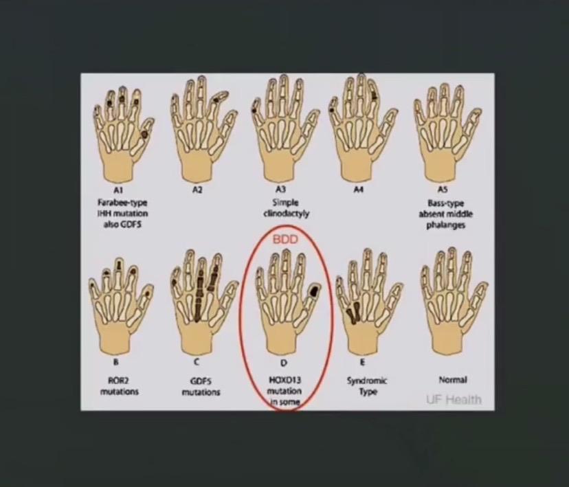为什么我的大拇指又宽又短？ 微医（挂号网）